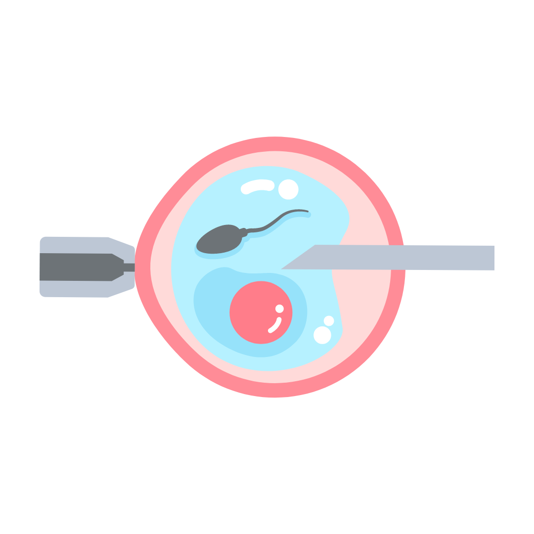 L'ICSI : ce qu'elle est et pourquoi elle a de meilleurs taux de ...